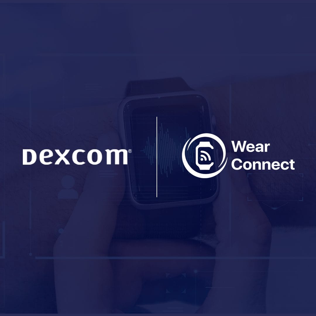 Dexcom API Integration | WearConnect